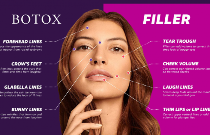 Botox – Facial Aesthetic Solutions